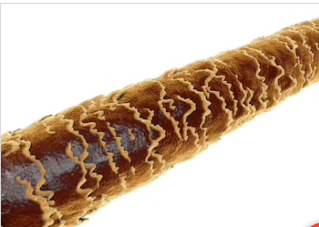 Hair Under the Microscope and Trichoscope - Otter Valley Trichology Clinic