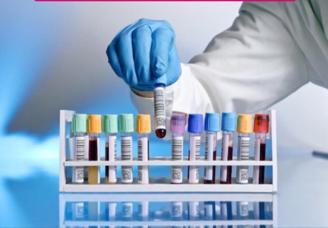 Blood Tests for Hair Loss - Otter Valley Trichology Clinic